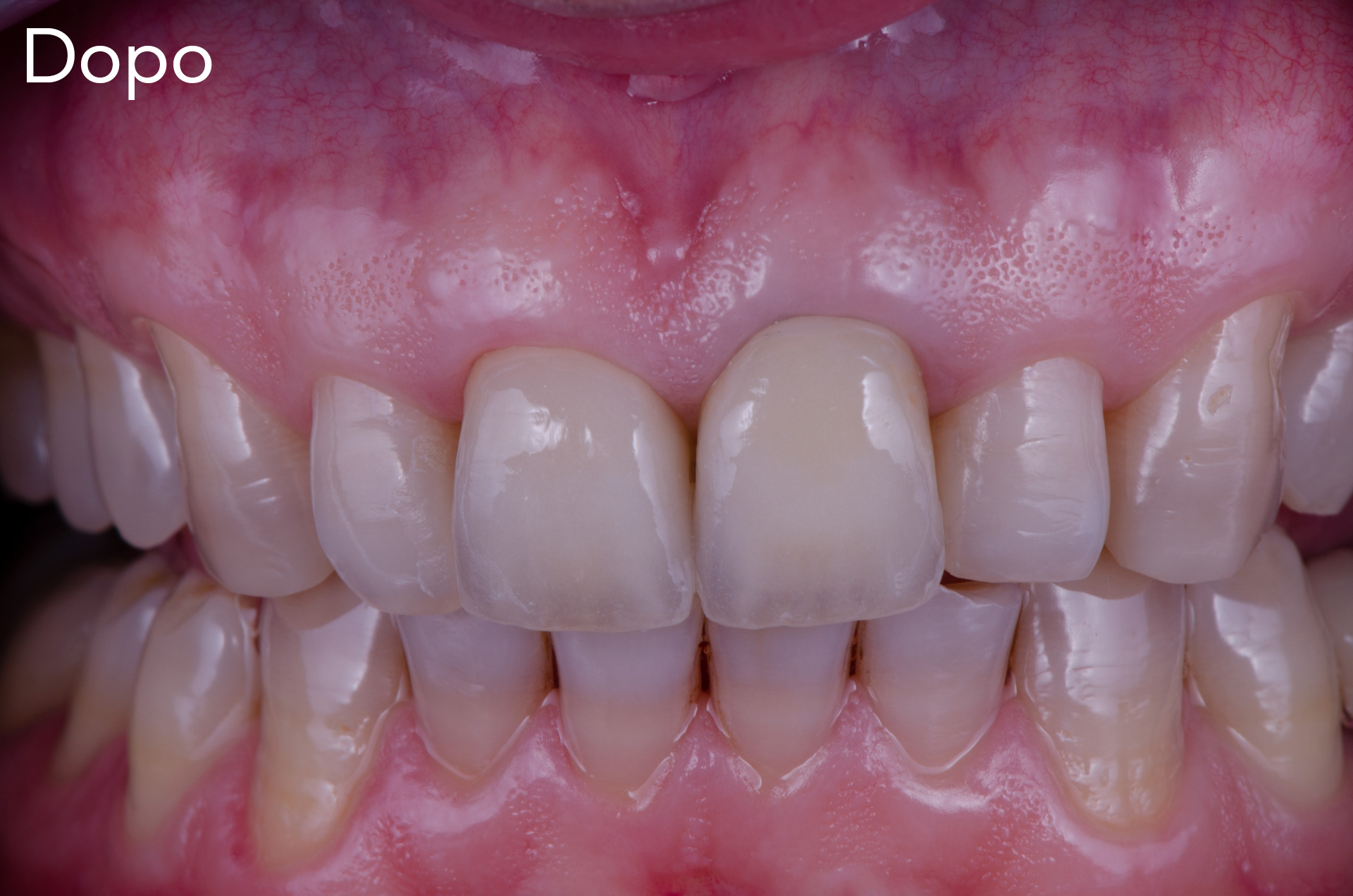 A seconda del caso è possibile raggiungere risultati molto confortevoli ...